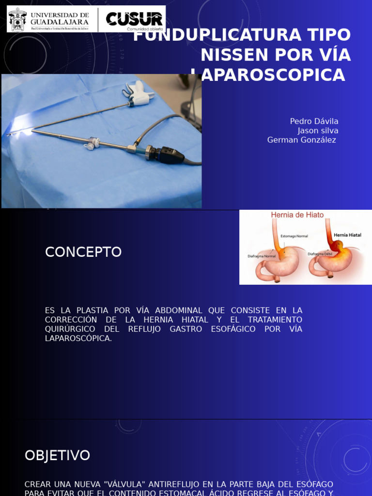 Funduplicatura Tipo Nissen Por Via Laparoscopica Oook | PDF | La ...