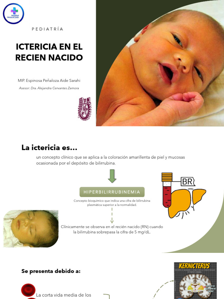 Ictericia Neonatal: Causas y Tratamiento | PDF | Medicina CLINICA ...