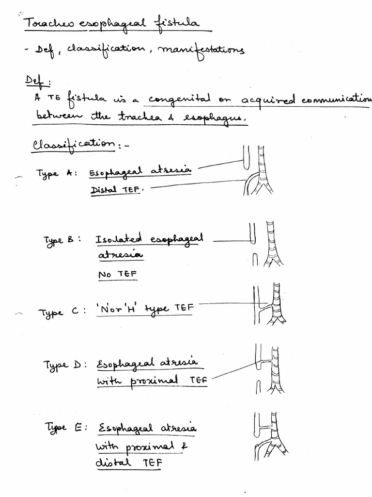 Tracheo Esophageal Fistula - Congenital | PDF