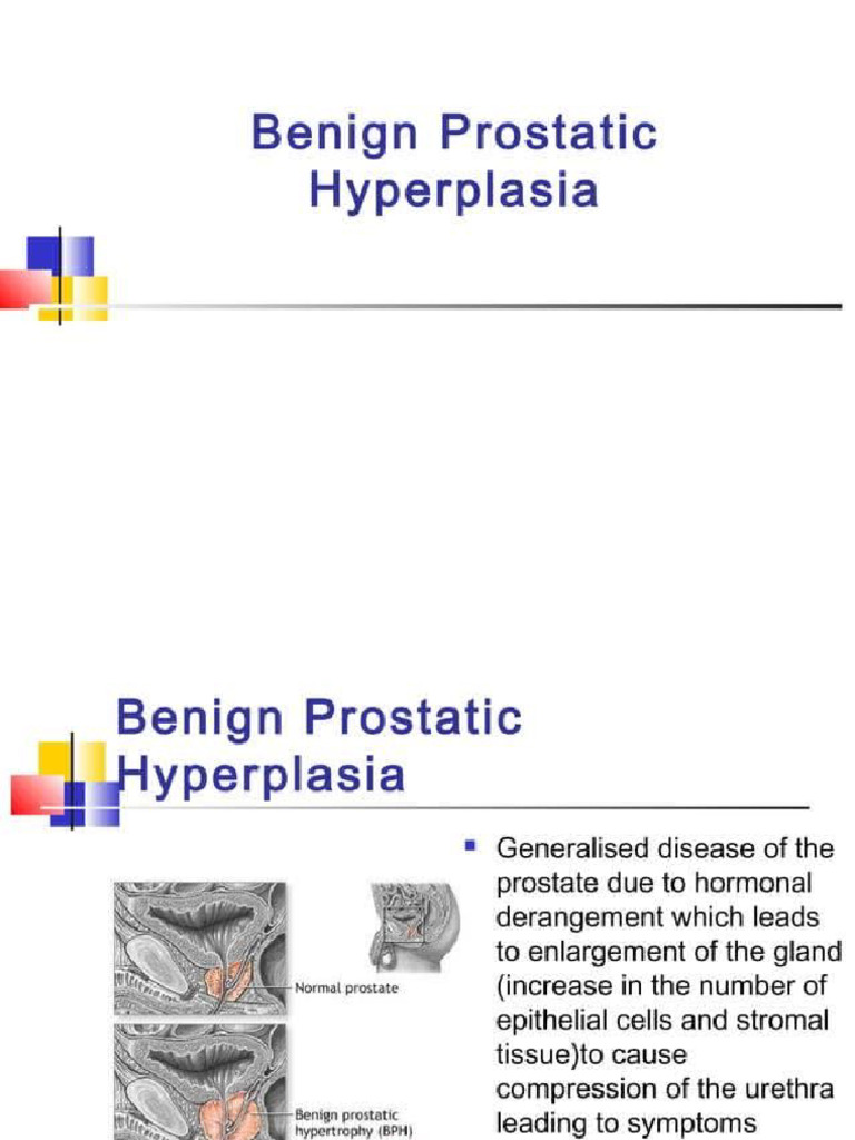 Benign Prostate Hyperplasia (BPH) | PDF