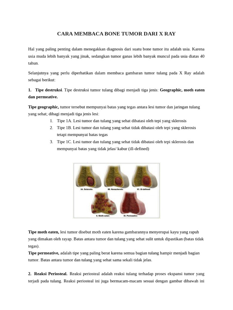 Panduan Membaca X-Ray Tumor Tulang | PDF