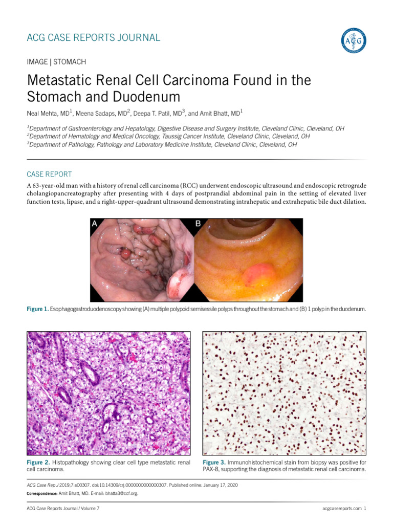 Metastatic Renal Cell Carcinoma Found in The.7 | PDF | Gastroenterology ...