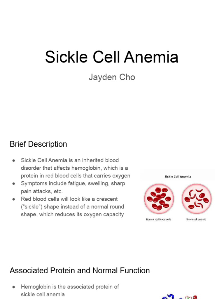 Sickle Cell Anemia | PDF