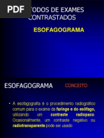 Exames Contrastados: Esofagografia Detalhada | PDF | Vômito | Esôfago