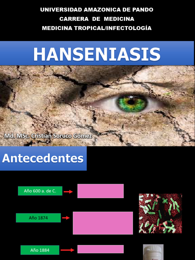 Hanseniasis: Definición y Diagnóstico | PDF | T Helper Cell | Sistema ...