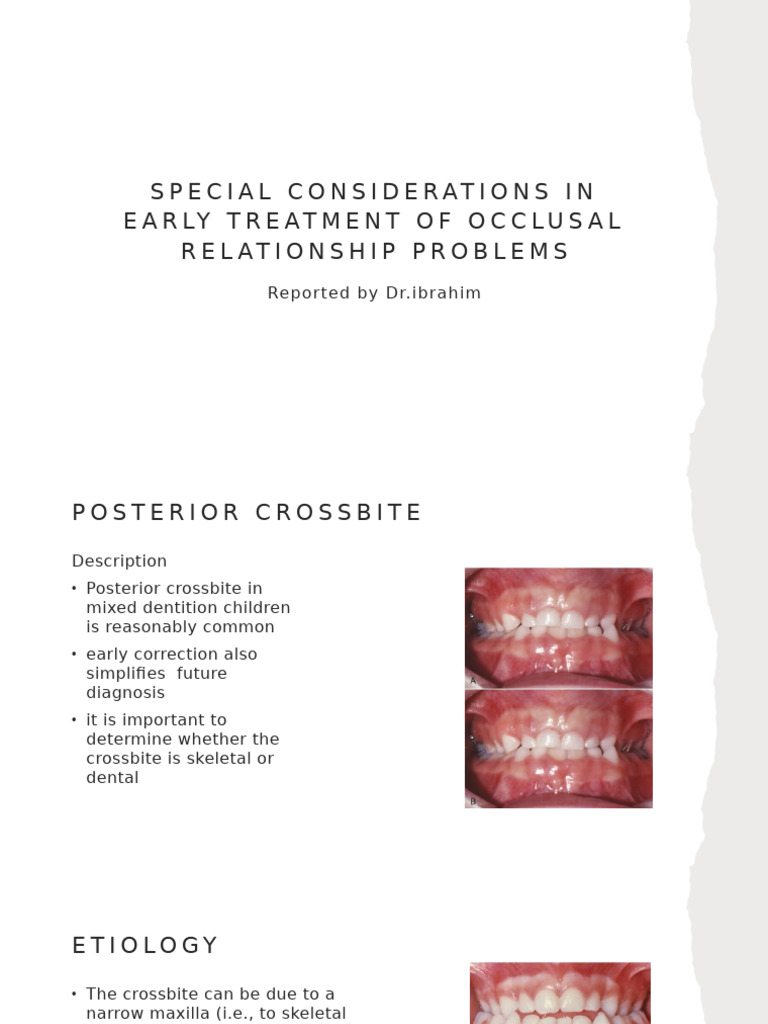 Special Considerations in Early Treatment of Occlusal Relationship ...