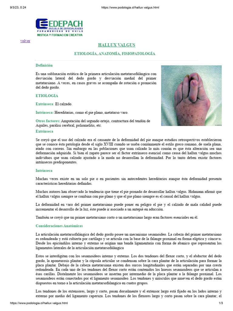 Hallux Valgus | PDF | Dedo del pie | Pie