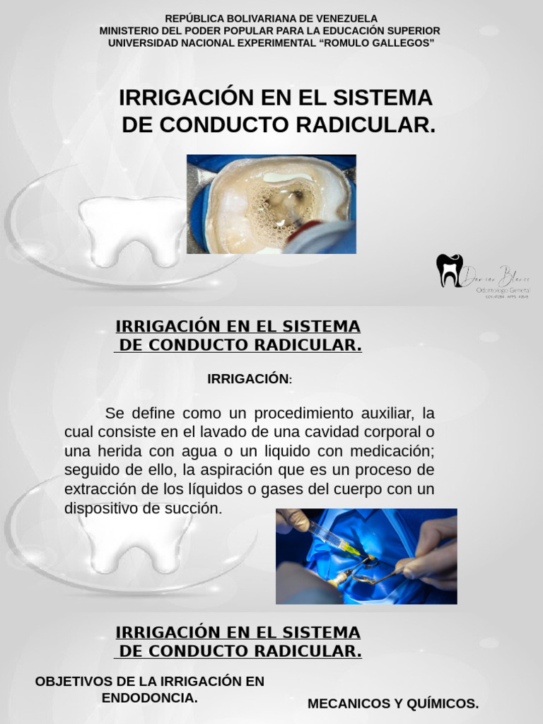 Irrigación en El Sistema de Conducto Radicular | PDF | Ácido ...