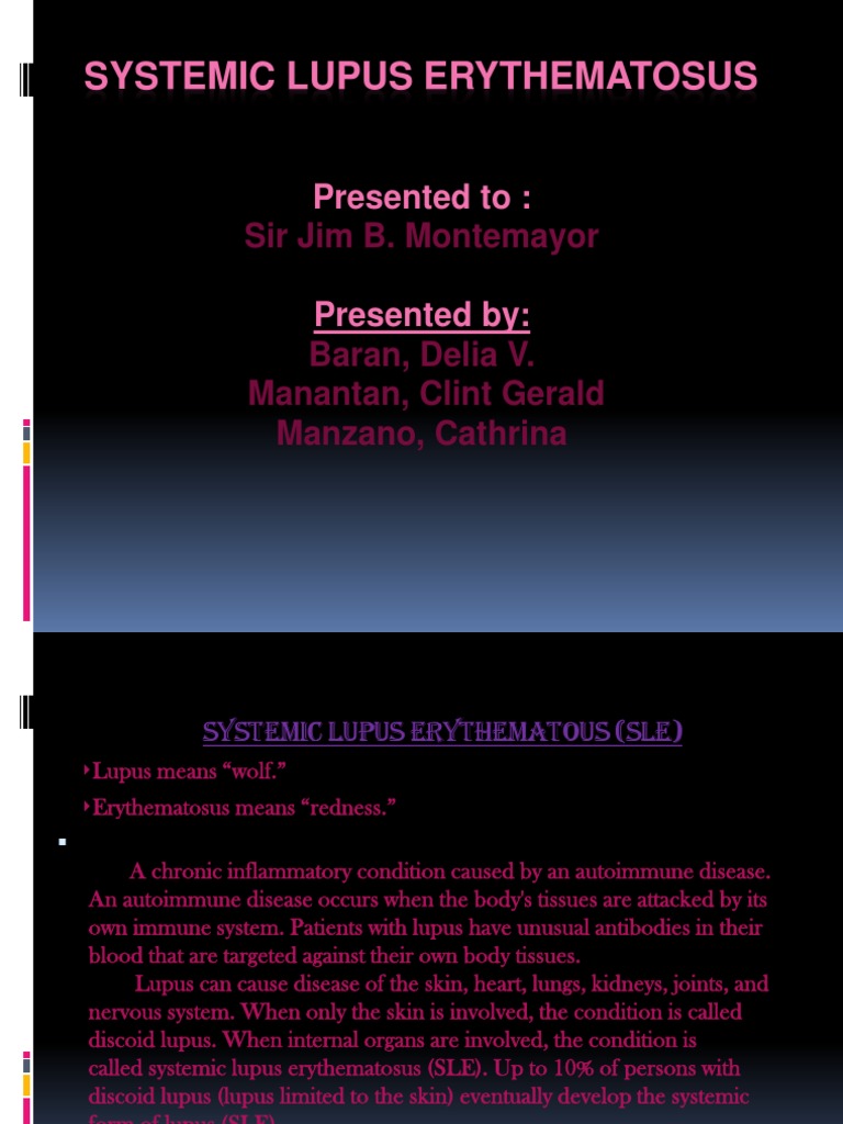 Systemic Lupus Erythematosus | PDF | Systemic Lupus Erythematosus ...