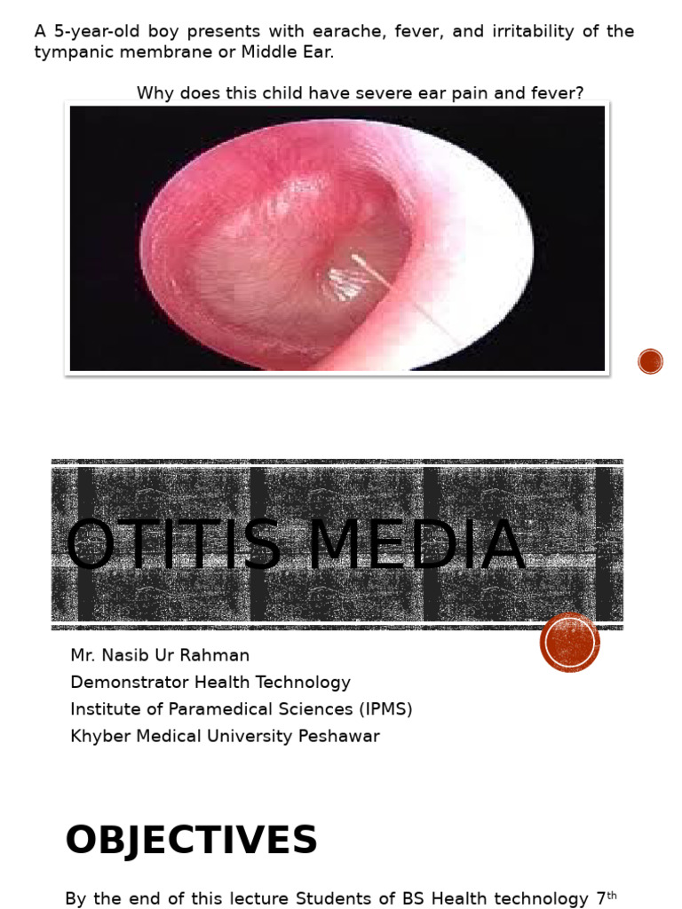 Lecture-4 (Otitis Media) | PDF | Ear | Medical Specialties