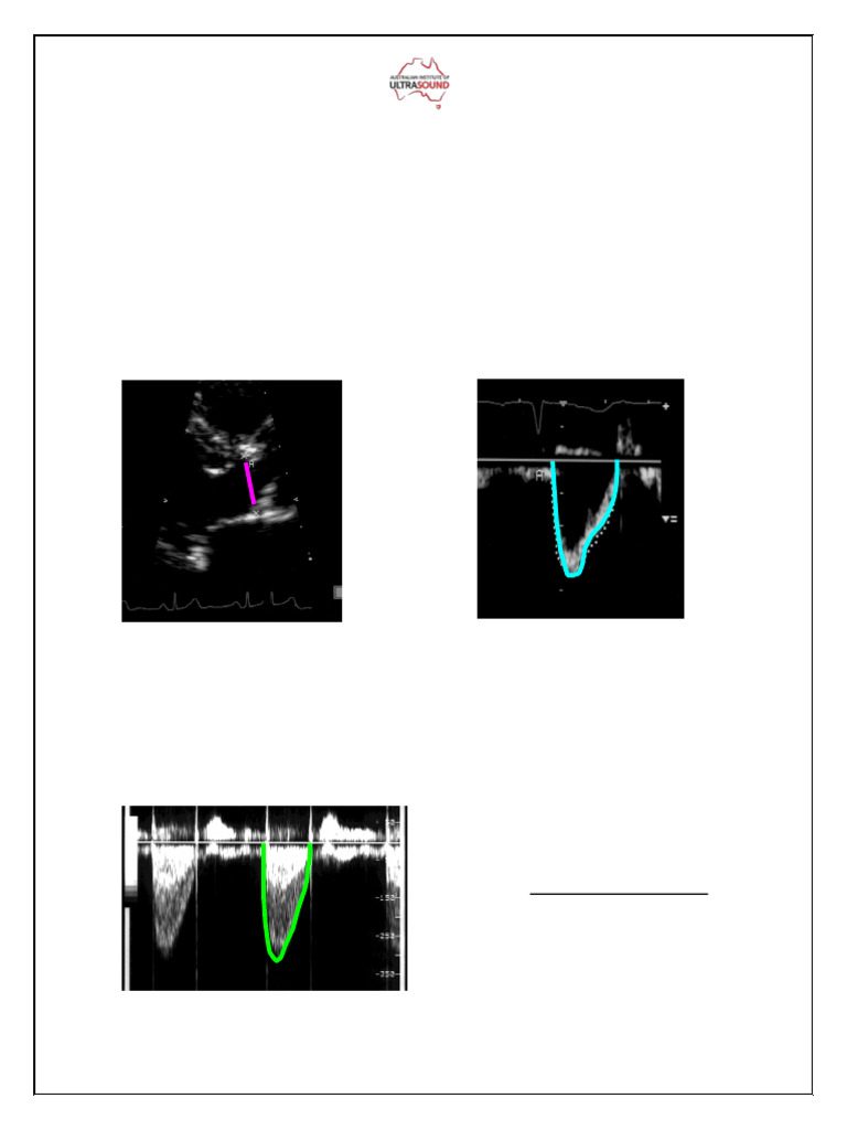 Handout - Valve Cards | PDF | Heart Valve | Cardiology