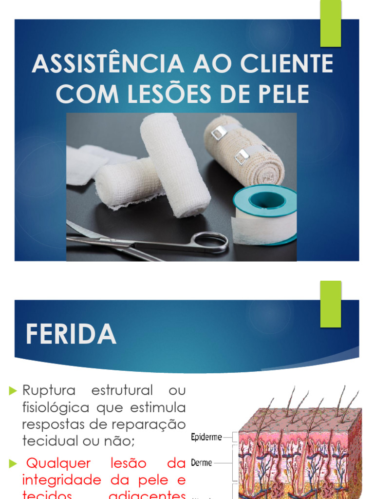 AULA 18- ASSIST. DE ENF. FERIDAS E CURATIVOS | PDF | Cura | Pele