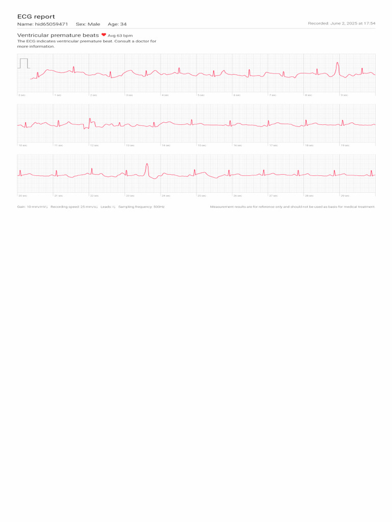 Ecg Report 2025 | PDF