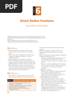 Frykman Classification of Distal Radius Fractures | PDF