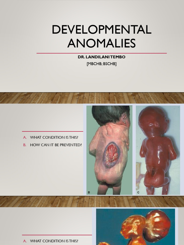 Developmental Anomalies | PDF