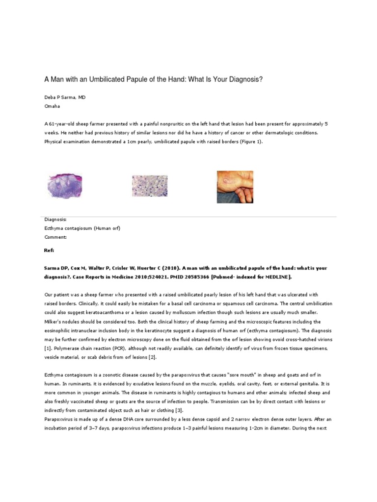 Ecthyma Contagiosum (Human Orf) | PDF | Cutaneous Conditions | Epidermis