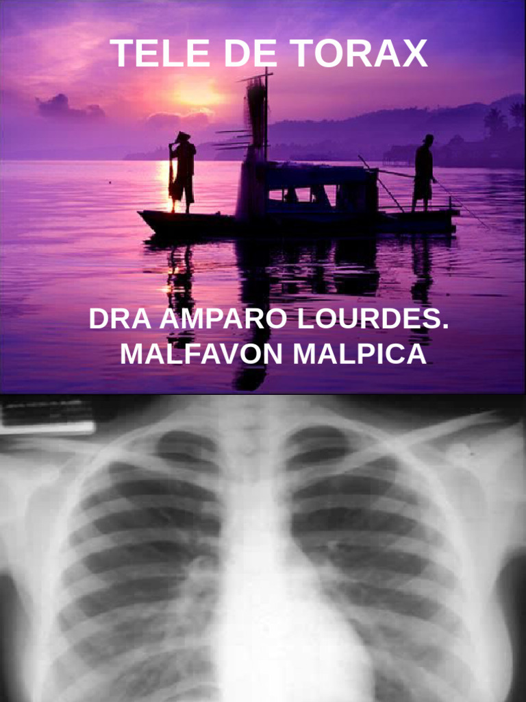 Platica de Torax | PDF