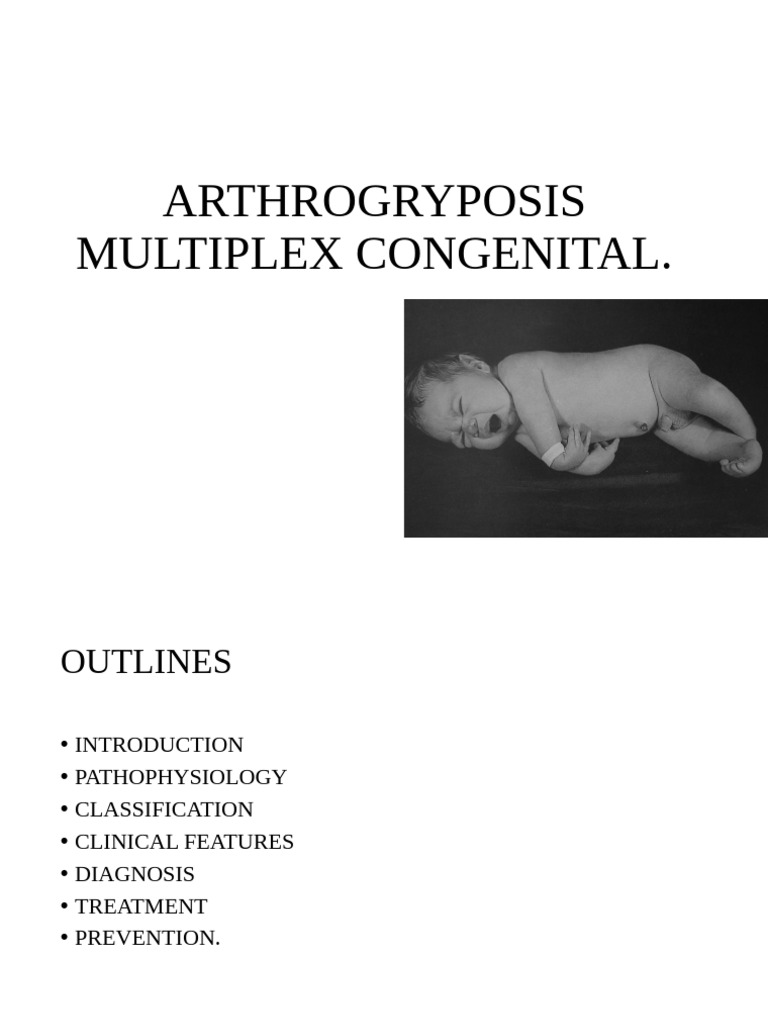 Understanding Arthrogryposis Multiplex | PDF | Human Diseases And ...