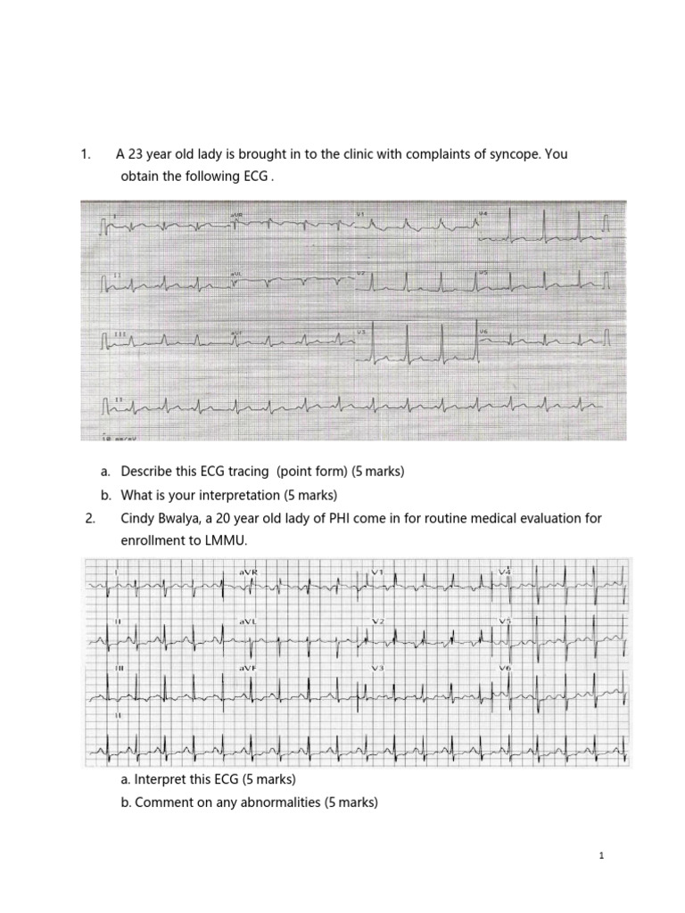 CVS ECG Tutorial Sheet 4 | PDF | Heart | Ventricle (Heart)