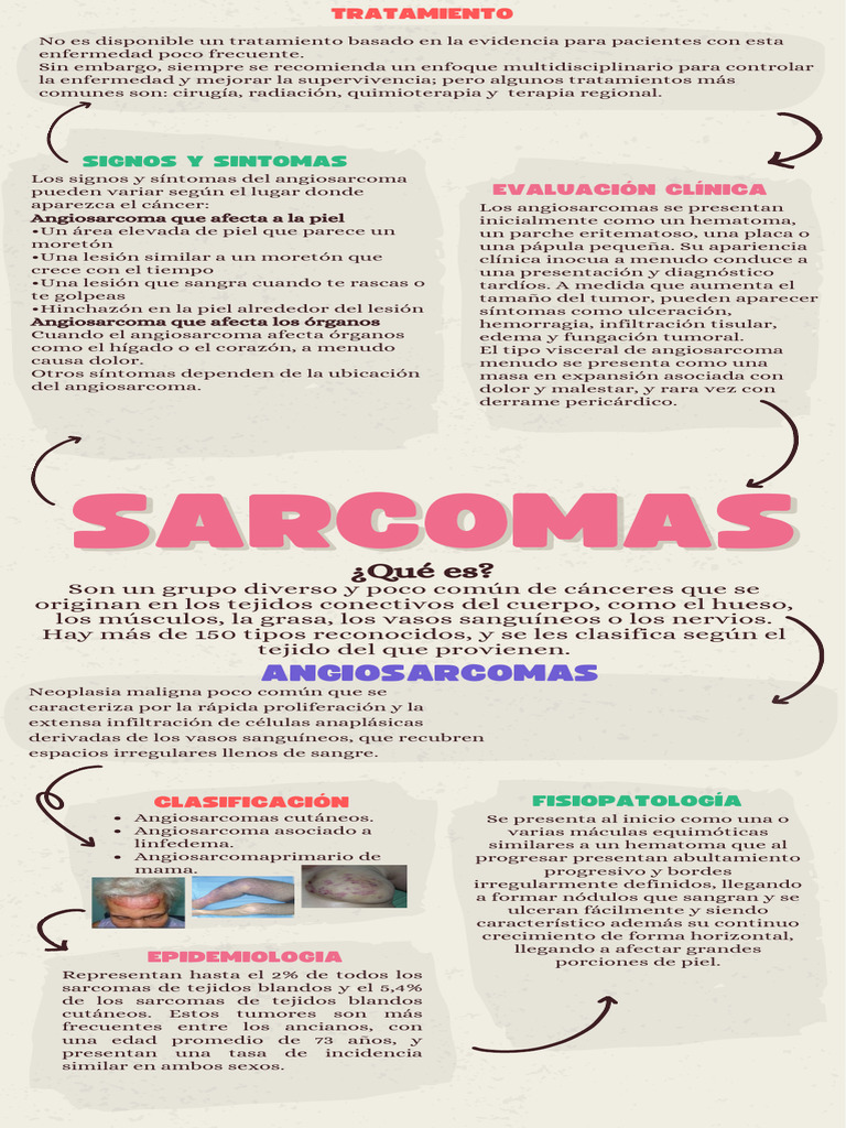 Tipos y Tratamientos de Sarcomas | PDF | Sarcoma | Cáncer