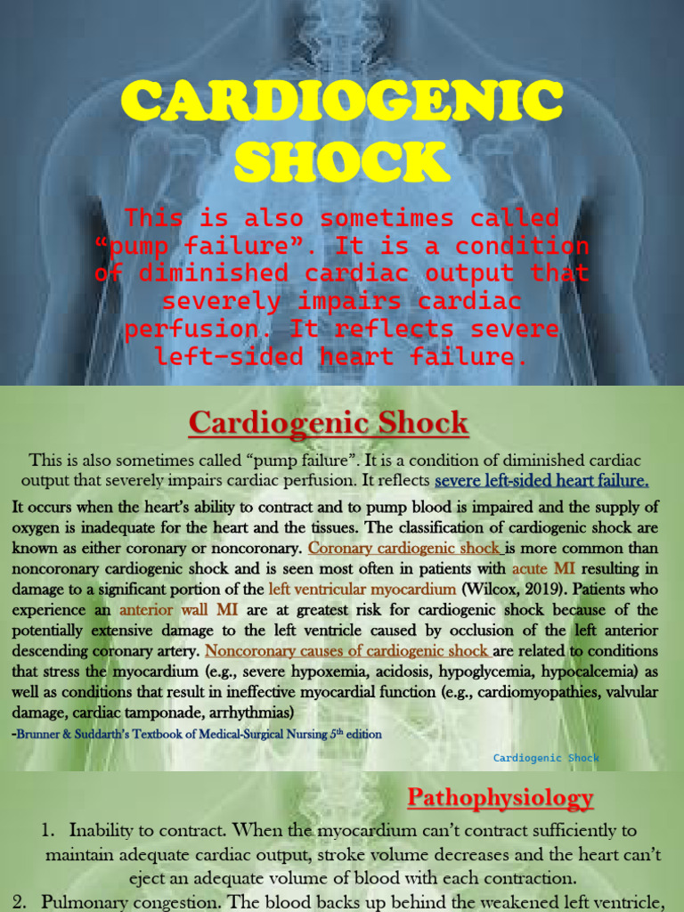 CARDIOGENIC SHOCK Session 7 | PDF | Heart | Shock (Circulatory)