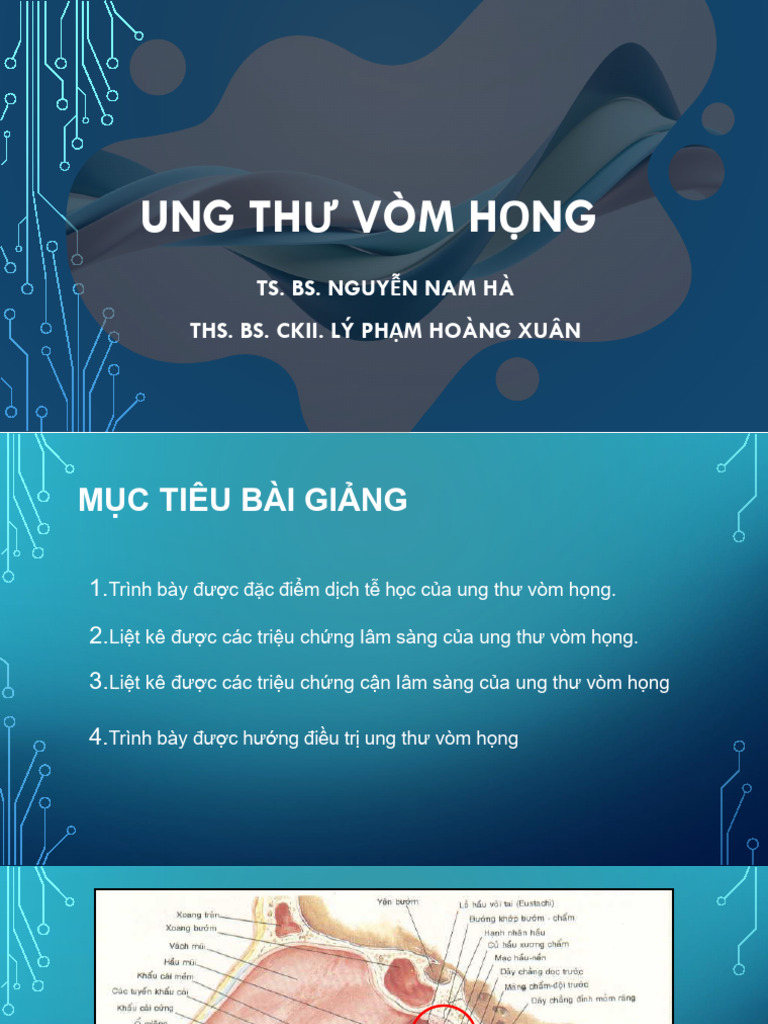 Ung Thư Vòm Họng | PDF