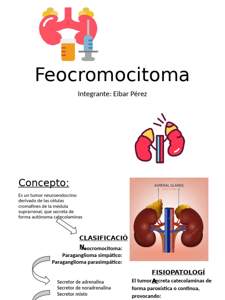 Feocromocitoma WPS Office | PDF | Medicina CLINICA | Especialidades Medicas
