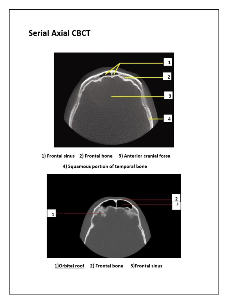 CBCT Anatomy 24-25 Master MIU | PDF | Human Nose | Human Head And Neck