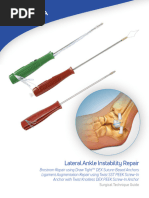 Brostrom Repair with InternalBrace Guide | PDF | Foot | Anatomical ...