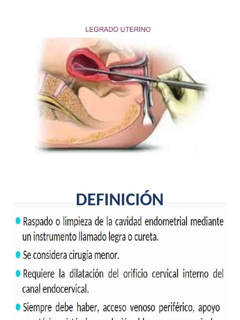 LEGRADO | PDF