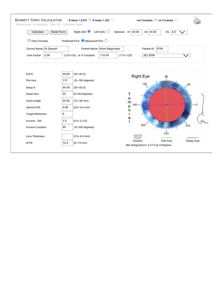 Toric Calculator V2.0 | PDF