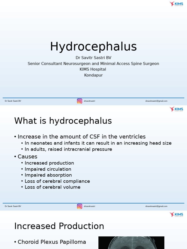 Hydrocephalus in Infants | PDF | Clinical Medicine | Medical Specialties