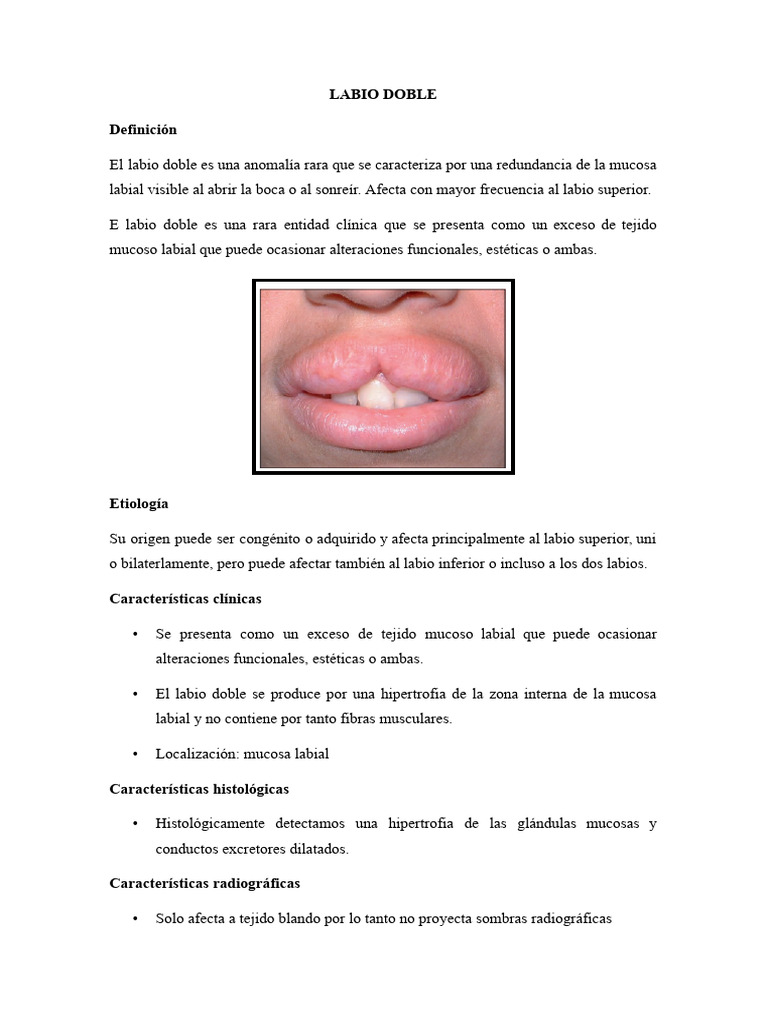 Labio Doble: Anomalía y Tratamiento | PDF