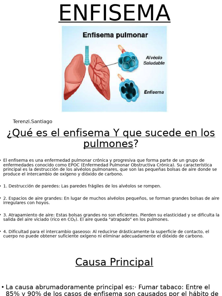 Enfisema: Causas y Síntomas Clave | PDF