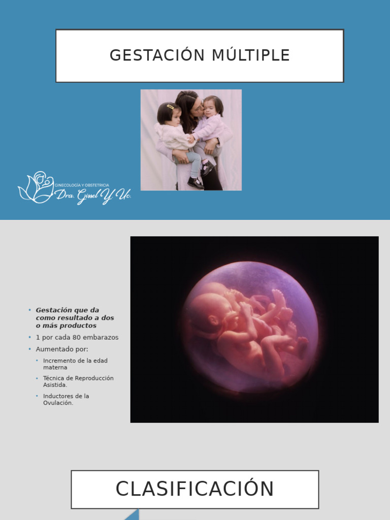 Gestación Múltiple | PDF | El embarazo | Gemelo