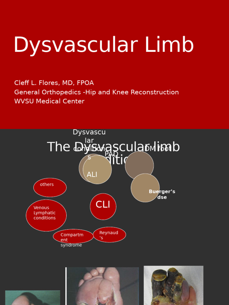 Dysvascular Limb Final | PDF | Ischemia | Toe