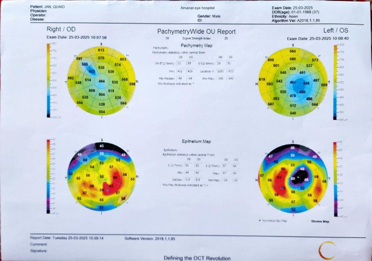 Quaid Jan Pachymetry Test | PDF