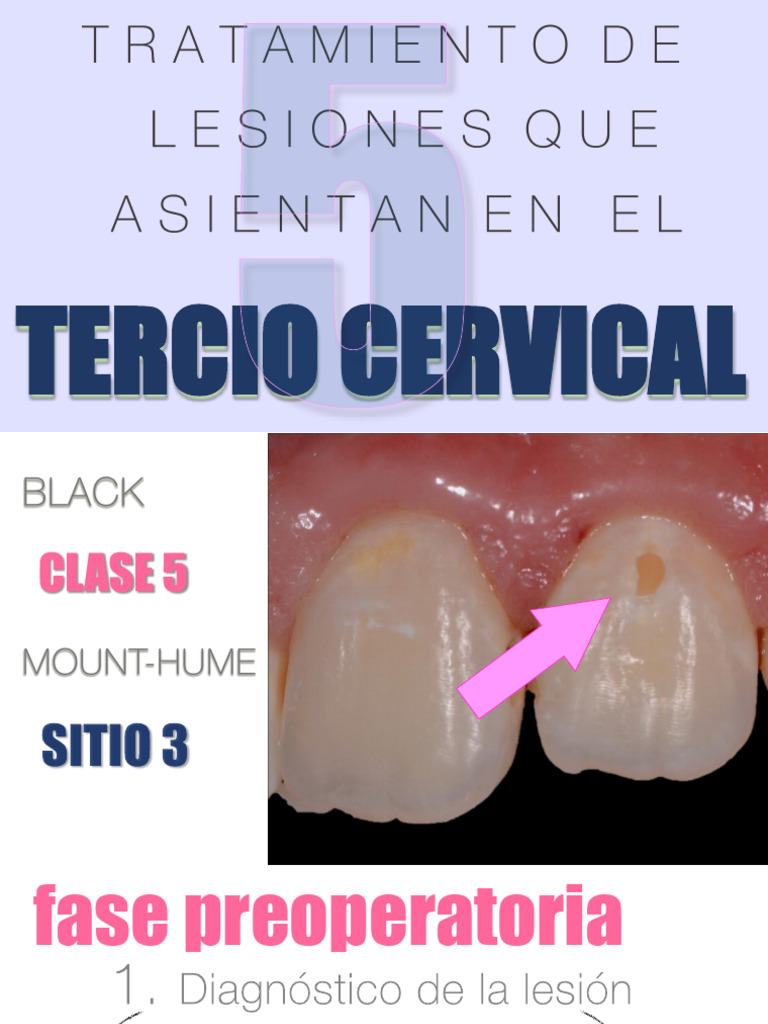 Clase 5 Lesiones Tercio Cervical de Black | PDF | Ciencias de la Salud ...