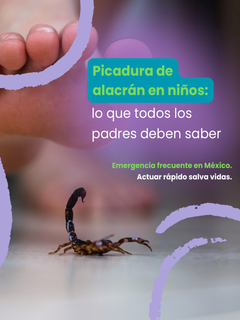 Picaduras de alacrán en niños: guía esencial | PDF