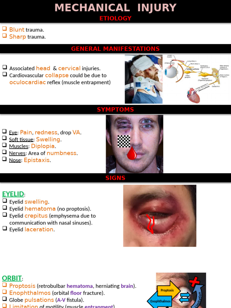 Ocular Trauma, Eye Trauma, Rupture Globe | PDF | Cornea | Medical ...