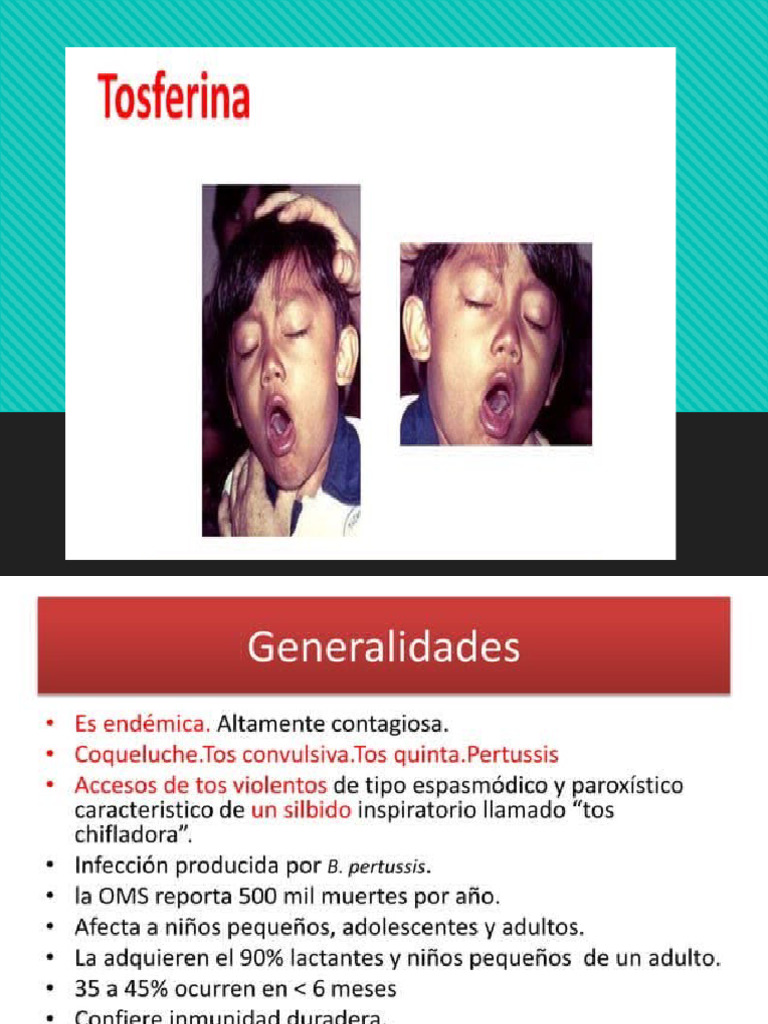 Tos Ferina | PDF