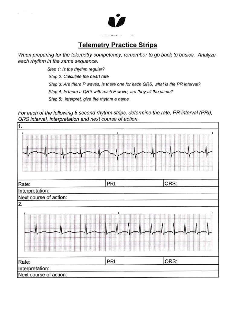 Practice Rhythm Strips | PDF