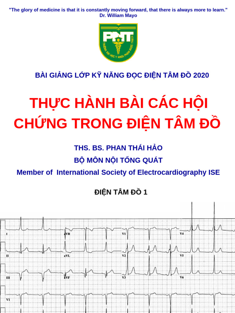 TH C Hành Bài H I CH NG Trong Ecg | PDF