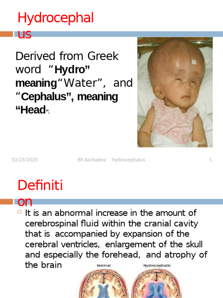 7 Hydrocephalus Day 3 | PDF | Cerebrospinal Fluid | Nervous System