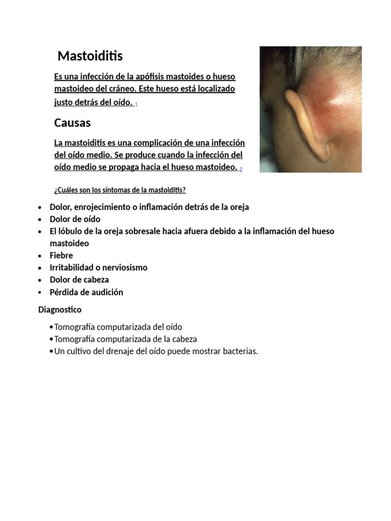 Mastoiditis: Síntomas y Tratamiento | PDF | Oído | Enfermedades y ...