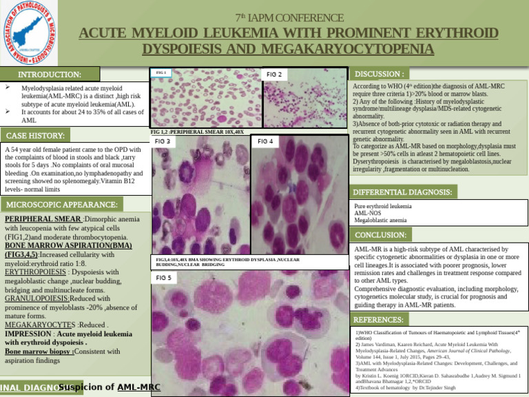 Aml MDS | PDF | Tissue (Biology) | Clinical Medicine