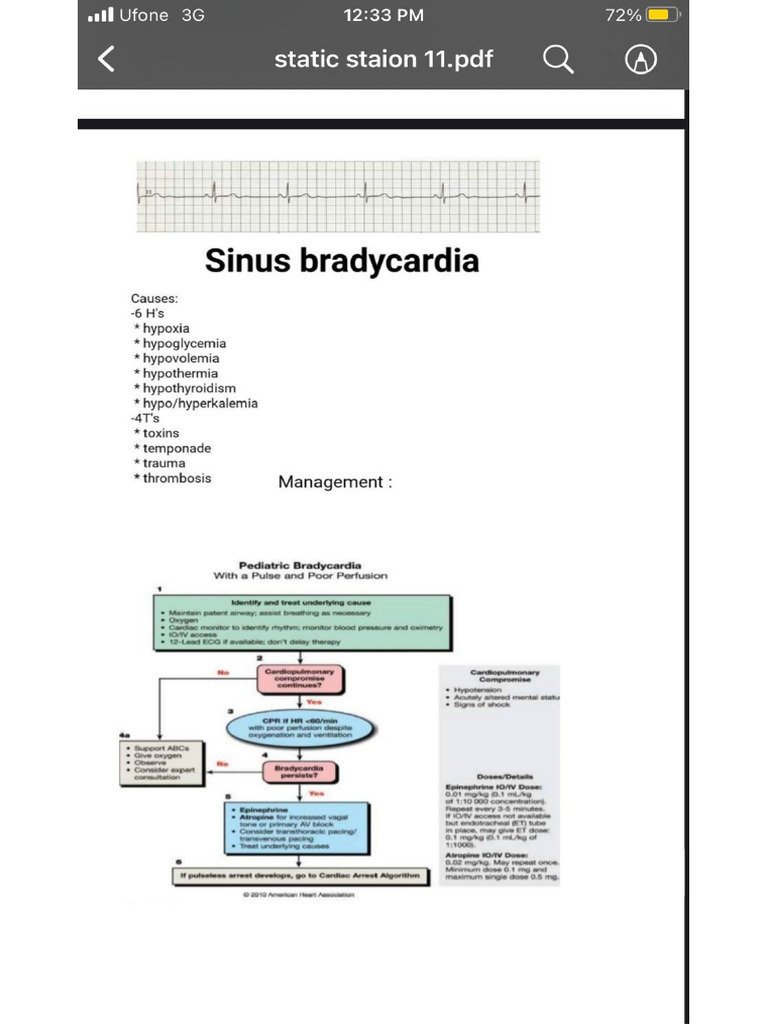 ECG Paeds | PDF