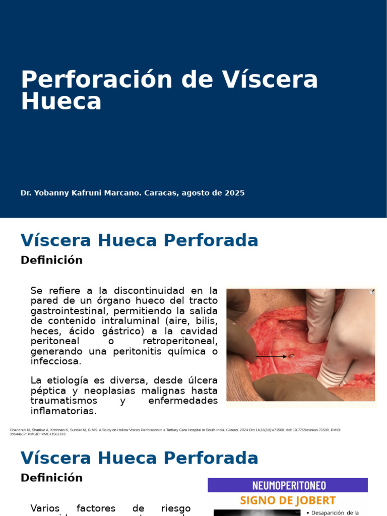Viscera Hueca Perforada | PDF | Especialidades Medicas | Enfermedades y ...