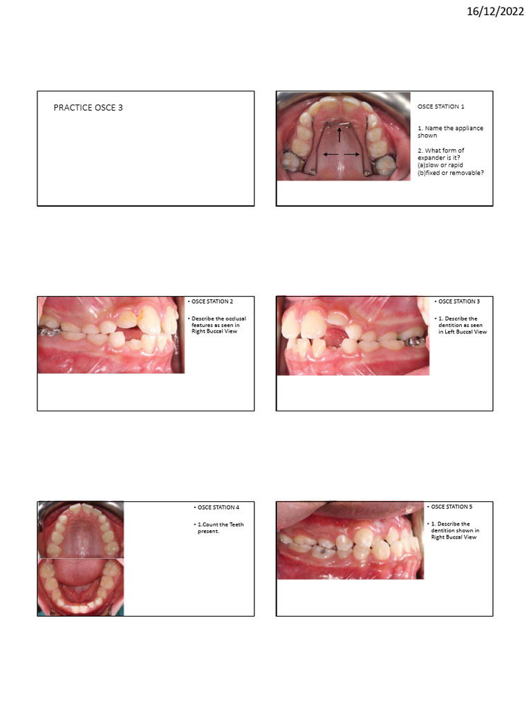 Practice Osce 3 | PDF | Orthodontics | Dentistry