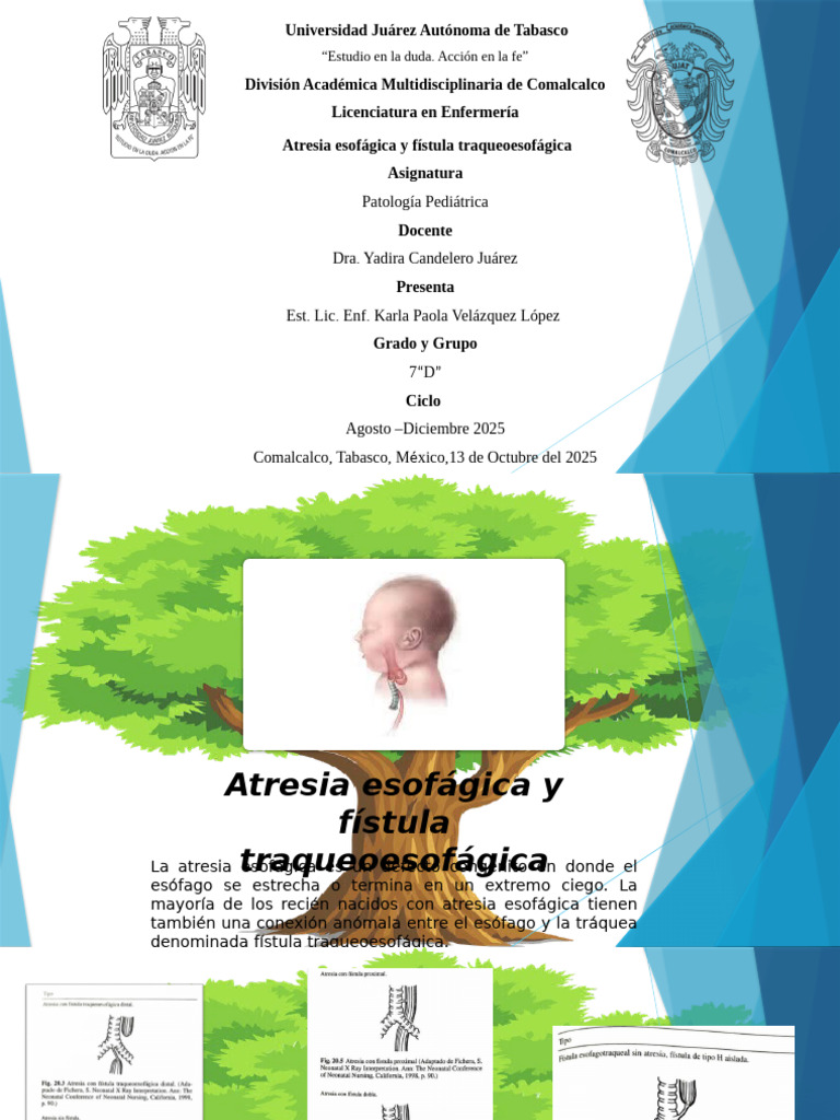 Atresia esofágica y fístula traqueoesofágica | PDF | Gastroenterología ...